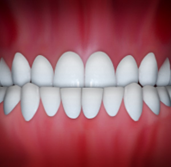 Common Orthodontic Problems | Gibb Orthodontics Lethbridge